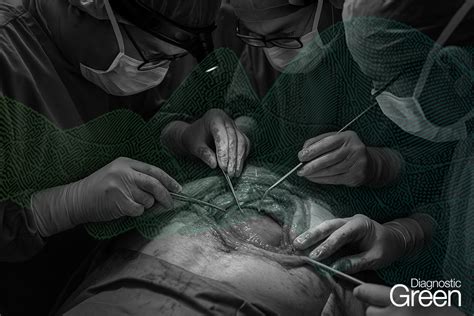 Icg Fluorescent Cholangiography In Laparoscopic Cholecystectomy