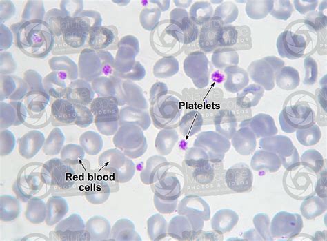 Plasmodium Slide Labeled