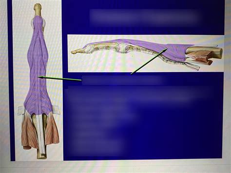 Extensor Expansion Diagram Quizlet