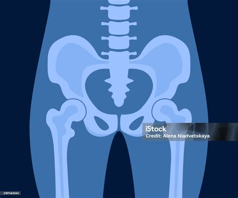 고관절 골반의 X레이 인간의 뼈 해부학 정형 외과 의료 진단 엑스레이 뢴트겐 방사선학 촬영 수술 대퇴골 건강한 골격 척추 해부학적 구조 이미지 벡터 일러스트 레이 션 다리