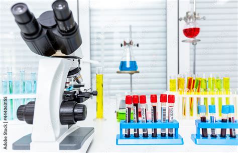 Room Test Tubes And Lab Samples Of Coronavirus Diagnostic Blood Test Mock Up Bottle Of Covid