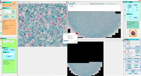 Cervical Cancer Positive Cell Slice Scanning Stitchingandidentification