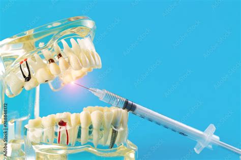 A Syringe With An Anesthetic Anesthetic Drug Makes An Injection Into An