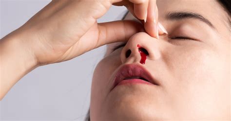 鼻血で上を向くのはNG医師が教えるケガの正しい応急手当て いのちをまもる図鑑 ダイヤモンドオンライン