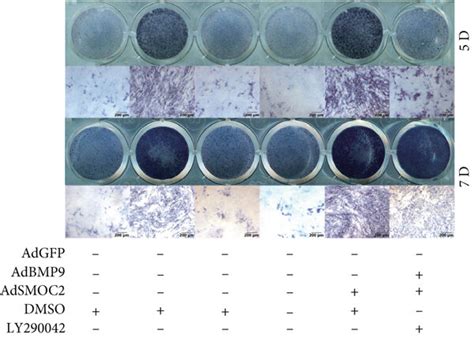 The Activation Of FAK AKT Signaling May Be Triggered By Facilitating Download Scientific
