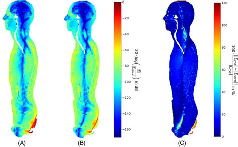 median plane of the “duke” body model 2 × 2 × 2 mm³ voxel resolution download scientific