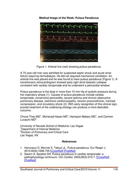 Pdf Medical Image Of The Week Pulsus Paradoxus
