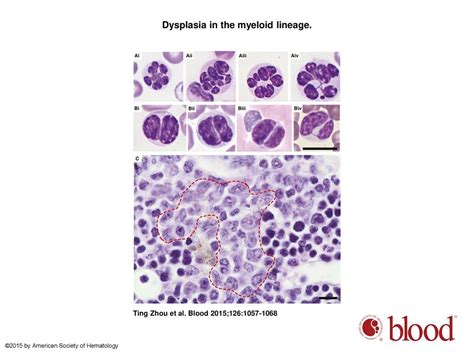Revisiting The Case For Genetically Engineered Mouse Models In Human