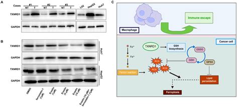 Figure 1 From Integrating Single Cell And Bulk Rna Sequencing To Identify Txnrd1 As Effective