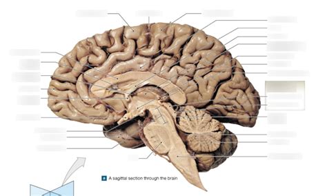 Saggital Section Through Brain Diagram Quizlet