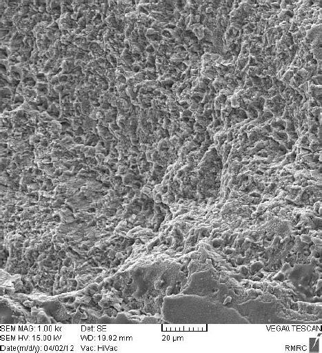 Enamel Surface After Conventional Acid Etching ×1000 Download