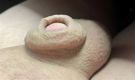 Tiny Micro Cock 20 Pics Xhamster