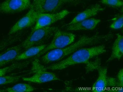 Sparc Antibody Cl488 66426 Proteintech