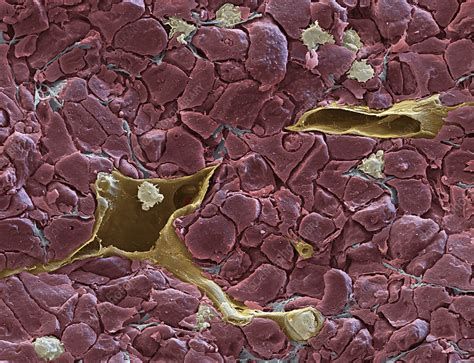 Tumour Blood Supply And Lymphocytes Sem Stock Image C0459711