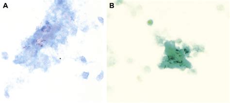 Mycobacterium Spp Intracellular Mycobacterium Spp In Macrophages Were Download Scientific