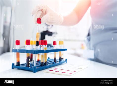 Closeup Man Worker Use Microscope In Laboratory Analyzing Blood Test