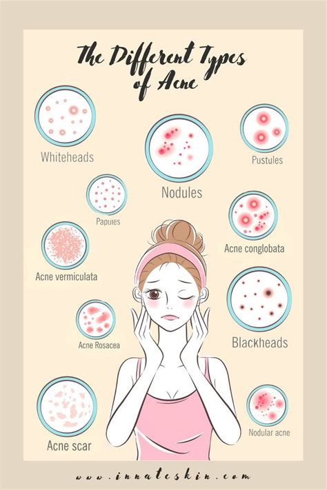 The Different Types Of Acne Which One Do You Have Innate Skin