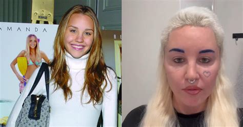 Amanda Bynes Before And After