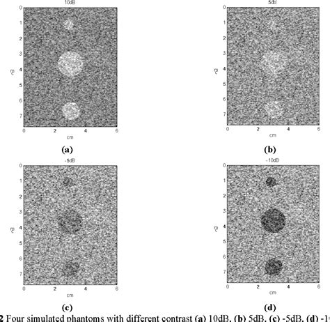 Figure 1 From Despeckle Filtering In Medical Ultrasound Imaging