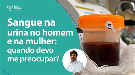 5 Causas De Hemácias Na Urina E Como Tratar