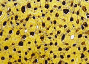 Difference Between Cytoplasm And Protoplasm Difference Between