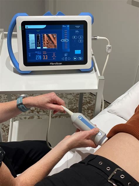 Fibroscan