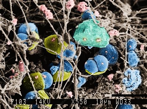Pollen Grains Sem Stock Image C0489828 Science Photo Library