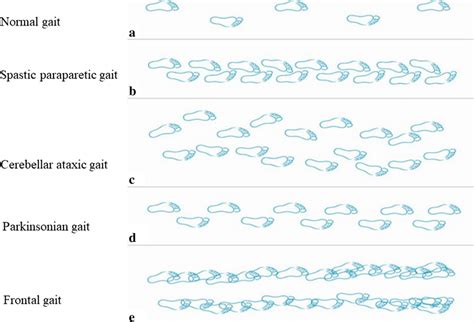 Graphical Representation Of The Step Sequence In People With And Download Scientific Diagram
