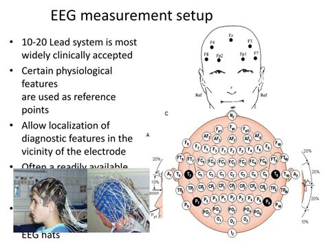 Ppt What Is Eeg Powerpoint Presentation Free Download Id5505871