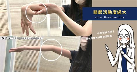 丁于旻主任 脊椎側彎非手術治療專家 4月 2022