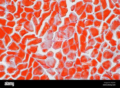 Skeletal Muscle Fibres Light Micrograph Hi Res Stock Photography And