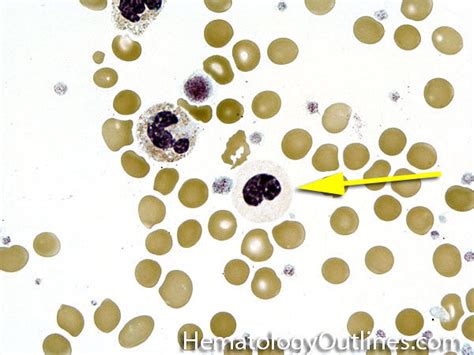 Hematologyoutlines Atlas