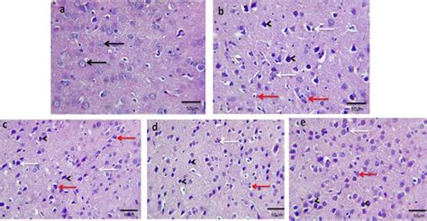 Histology Of Cerebral Cortex Stained With Hande X400 A Control Rats B