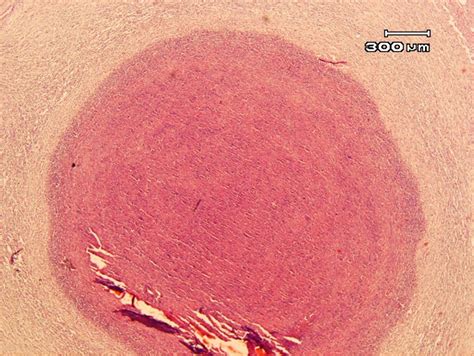 Microscopic View Of Prescapular Lymph Node Infected With C Download Scientific Diagram