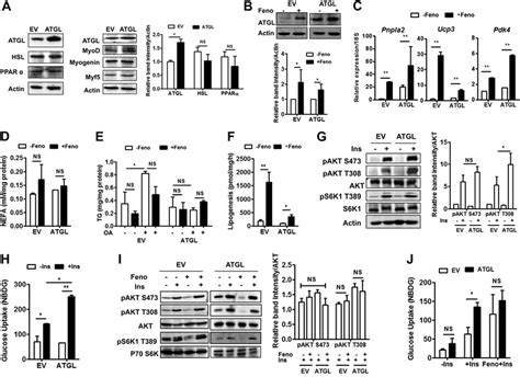 Atgl Does Not Play A Role In Fenofibrate Induced Lipid Accumulation And