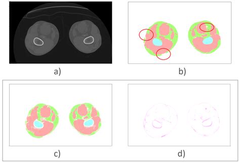 3 Multi Class Segmentation Of A Ct Scan Slice Showing The Legs Of A