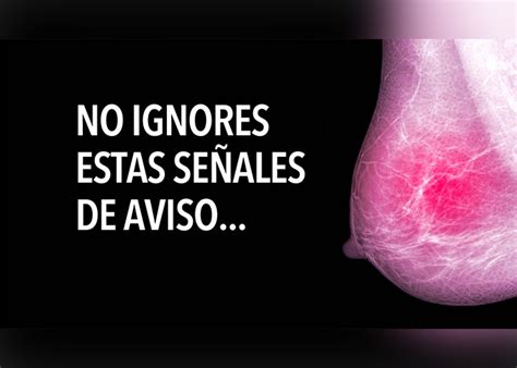 Estas Son Las Señales Del Cáncer De Mama A Las Que Debes Estar Alerta