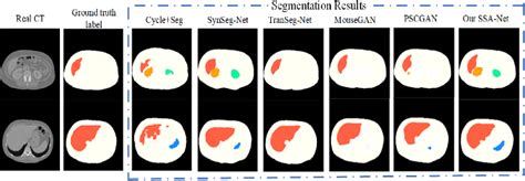 Figure 1 From Attention Based Cross Domain Synthesis And Segmentation