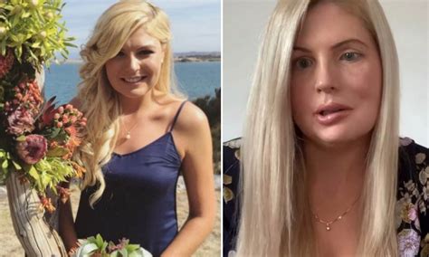 Healthy Paramedic Suffers Stroke That Started With Subtle Symptom