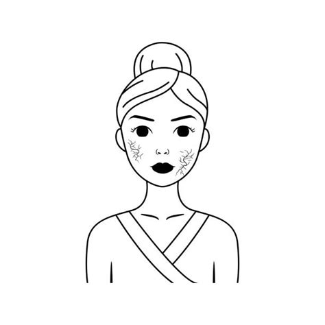 20 Dry Skin Face Winter Stock Illustrations Royalty Free Vector