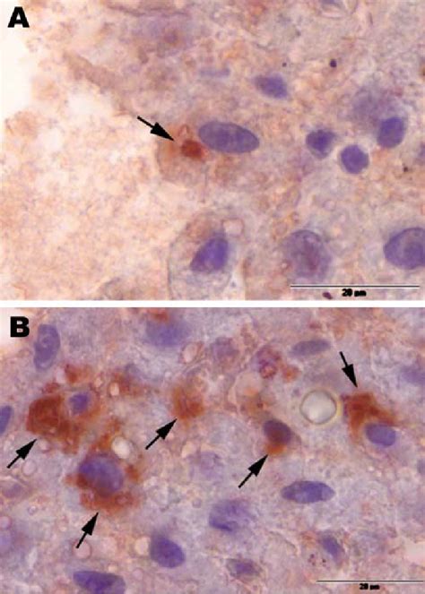 Immunohistochemical Staining Peroxidase Antiperoxidase Pap