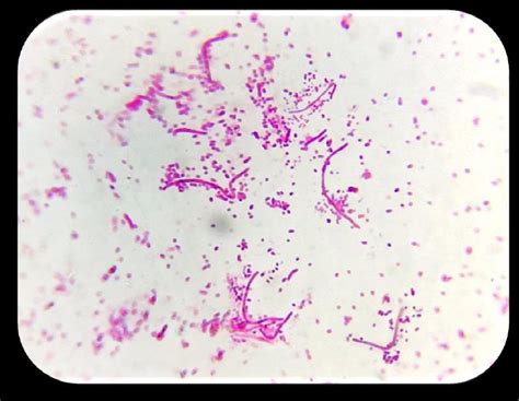 17 Co Aggregated Cells Of Pgingivalis And Tdenticola Stained With