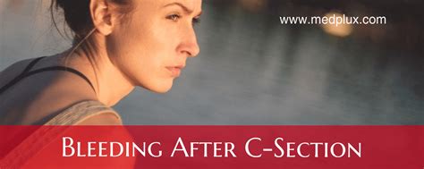 Bleeding After C Section How Long Will It Last Danger Signs