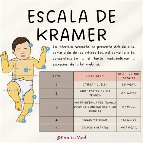 Escala De Kramer Paula Udocz
