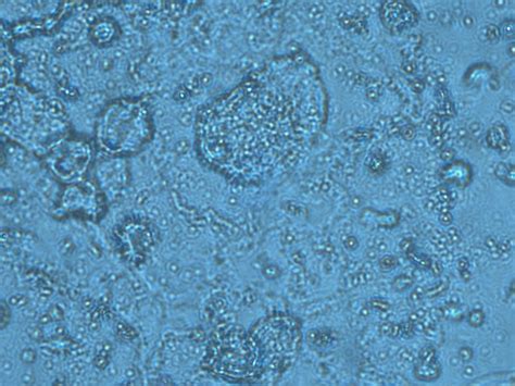 Contamination In Sk N Sh Neuroblastoma Cell Culture Researchgate