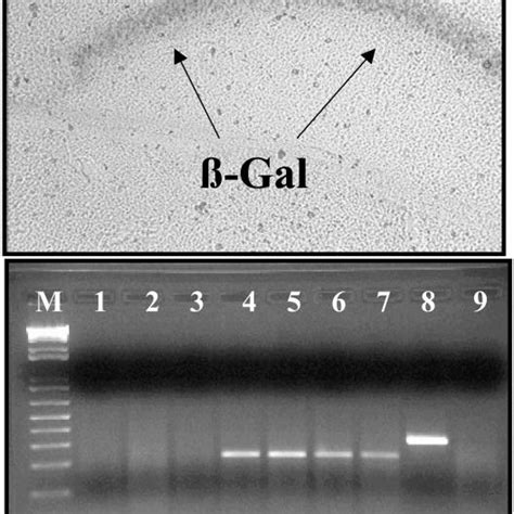 Aortic Pressure Gradient Across Coarctation Representative Pressure Download Scientific