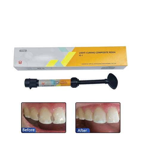 Hybrid Dental Composite Resin Filling Materials Universal Light Curing Composite Resin A1 A2 A3