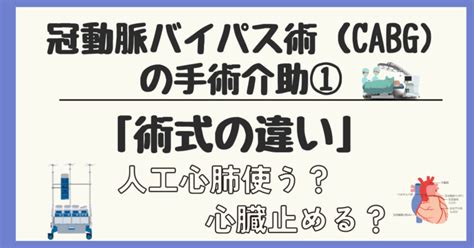 【術式の違い】冠動脈バイパス術（cabg）の手術介助①
