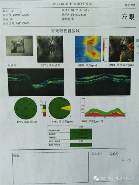 典型显效病例 双眼Leber遗传性视神经病变 典型案例 陕西培荣中医眼科医院