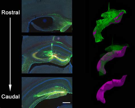 Anatomical Spread Of Lentiviral Injection Stereotaxic Coinjection Of A Download Scientific